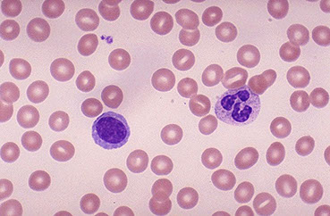 Agranular Leukocytes